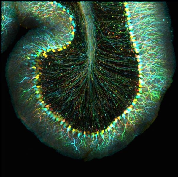 Getting the big picture of tiny brain cells | News | Des Moines University