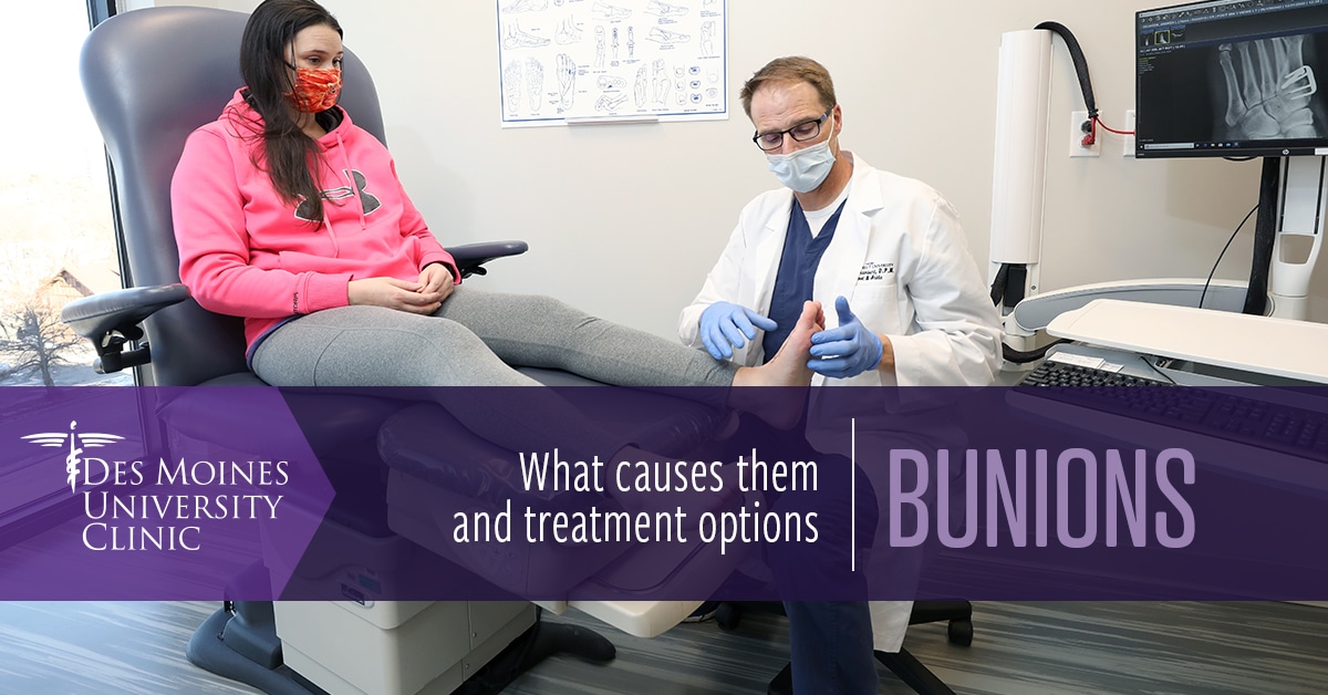 What caused my bunion, and what can I do about it? | News | Des Moines ...